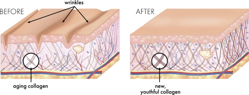 Skin Tightening & Skin Care | Cosmetic Skin & Laser Center