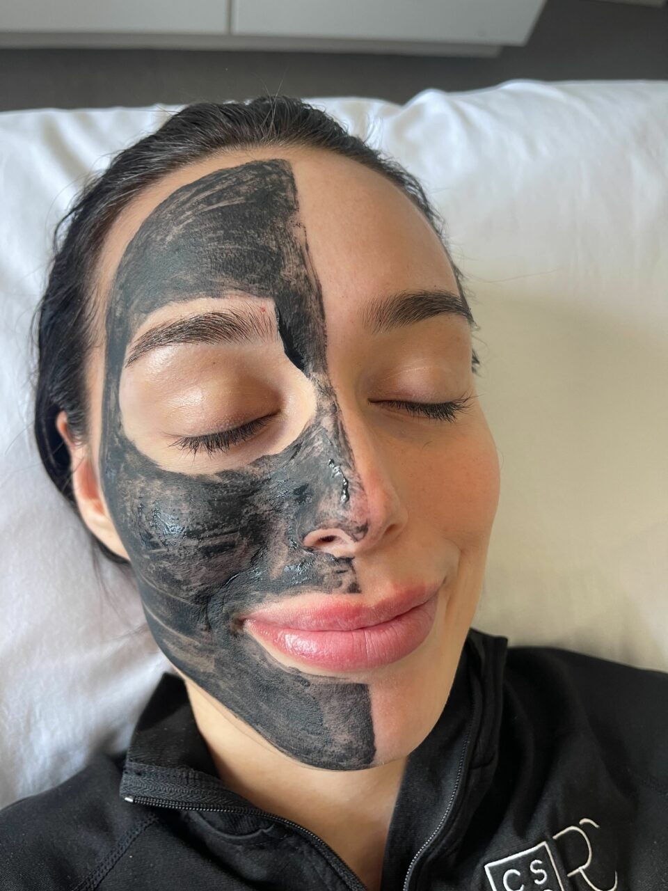 Carbon Laser Peel | Acne, Pores & Oil Control | CSLC